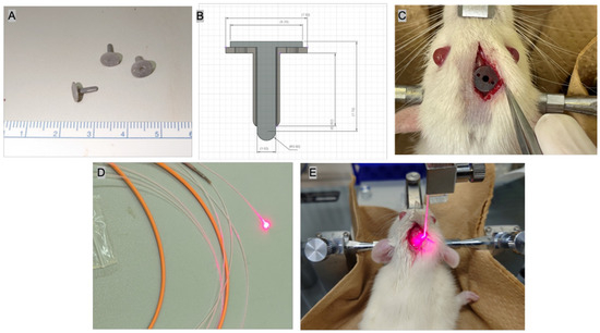 Cytocidal Effects of Interstitial Photodynamic Therapy Using Talaporfin ...
