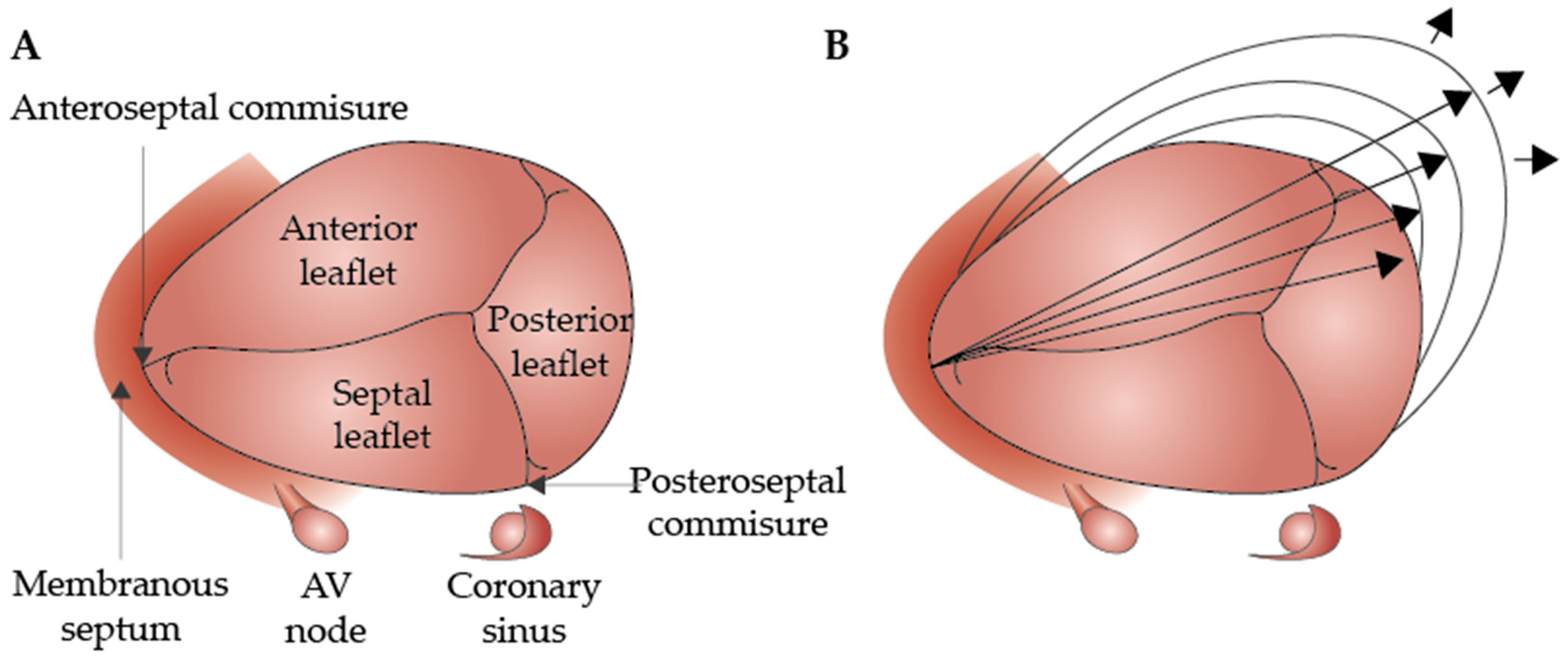 Sex Specific Insights Into Etiology Diagnosis Treatment And
