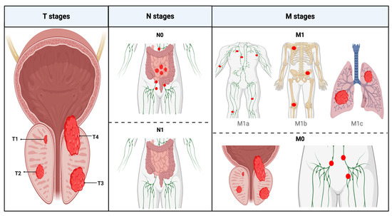 A Transfer Learning-Based Framework for Classifying Lymph Node ...