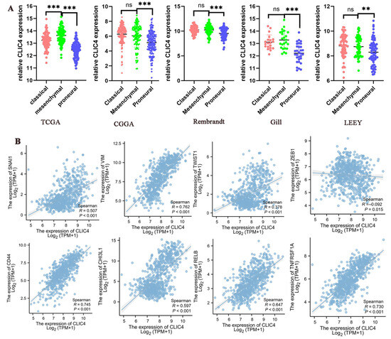 CLIC4 Is a New Biomarker for Glioma Prognosis