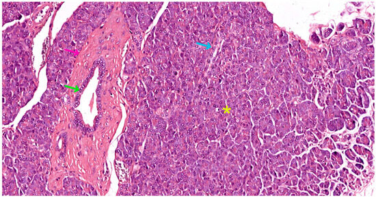 Pancreatic Morphology, Immunology, and the Pathogenesis of Acute ...