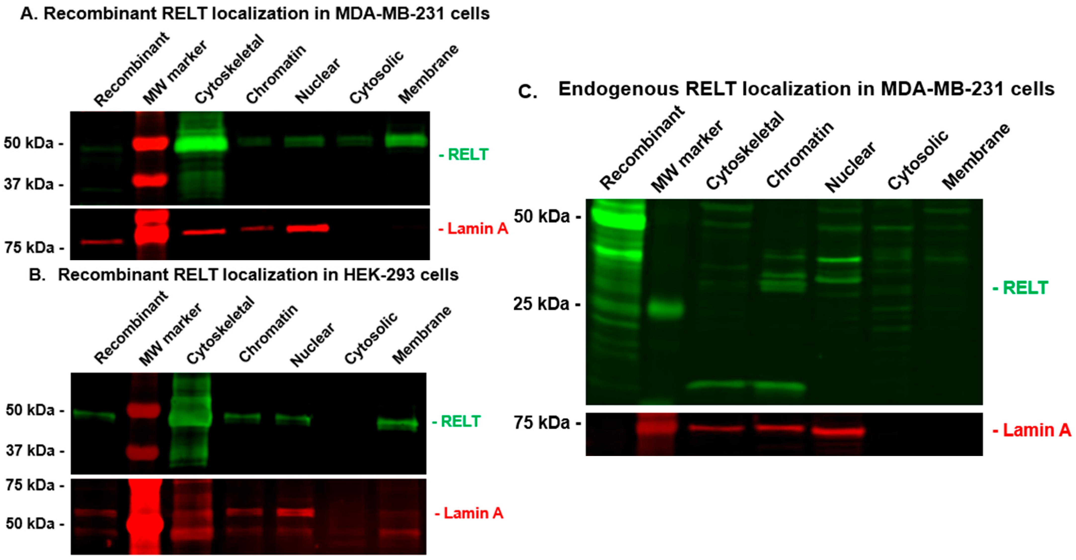 RELT Is Upregulated in Breast Cancer and Induces Death in Breast Cancer ...