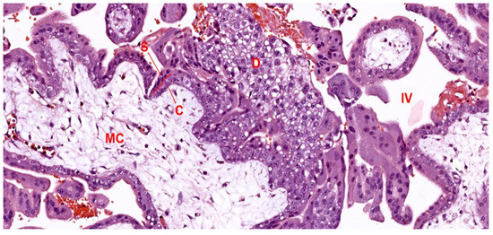 The Interplay of Molecular Factors and Morphology in Human Placental ...