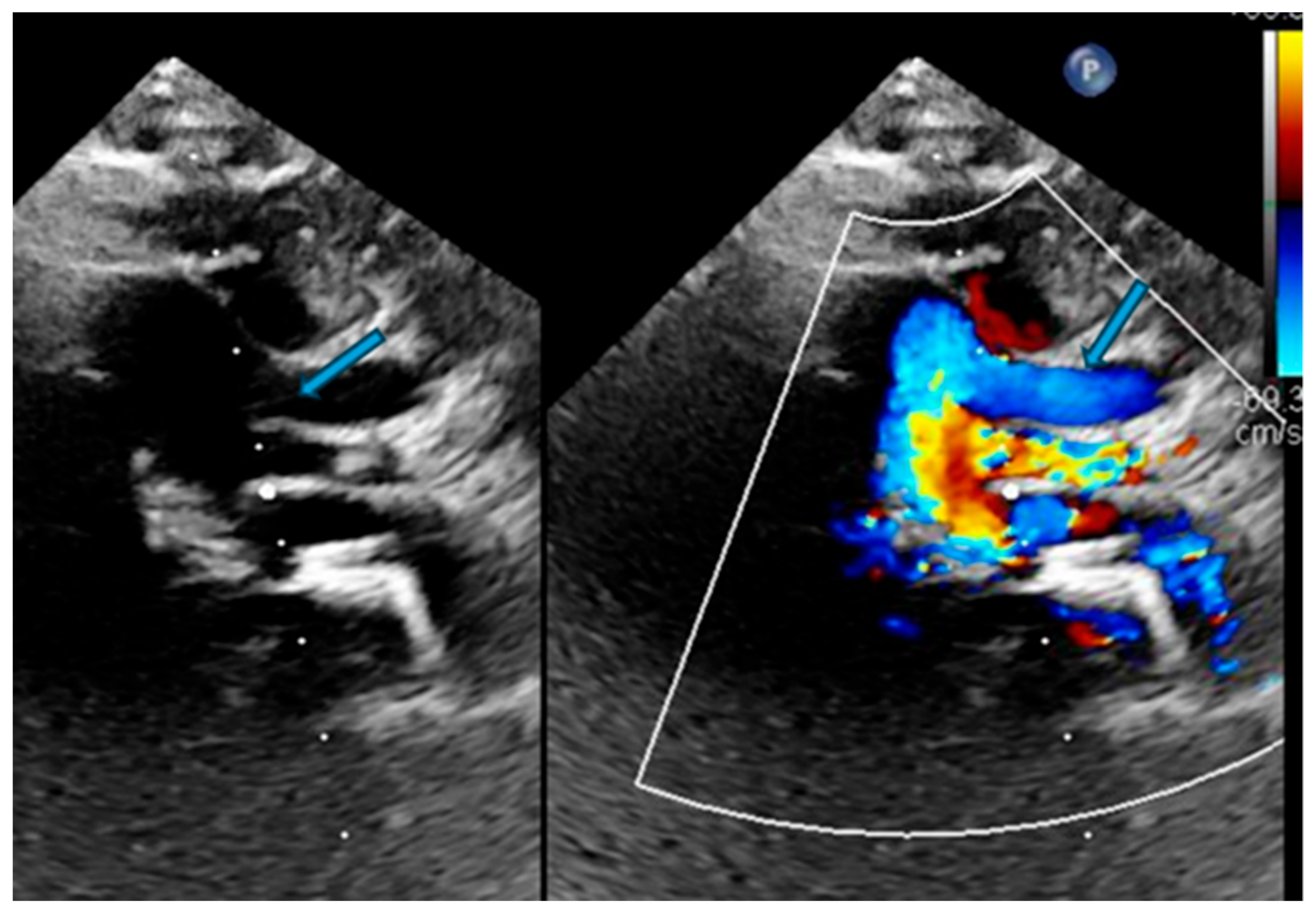 Understanding the Spectrum of Mild Clinical Outcomes and Novel Findings ...
