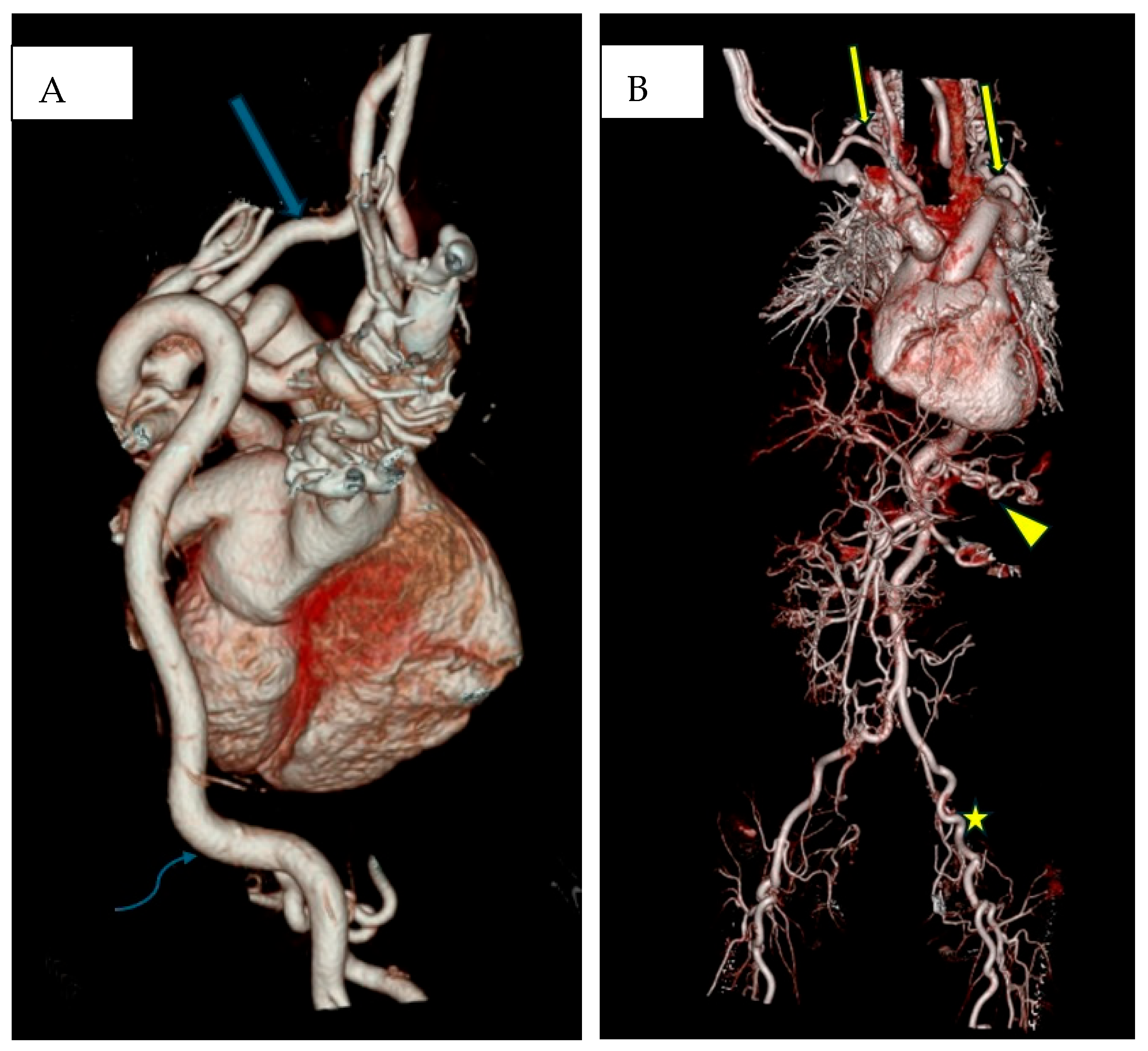 Understanding the Spectrum of Mild Clinical Outcomes and Novel Findings ...