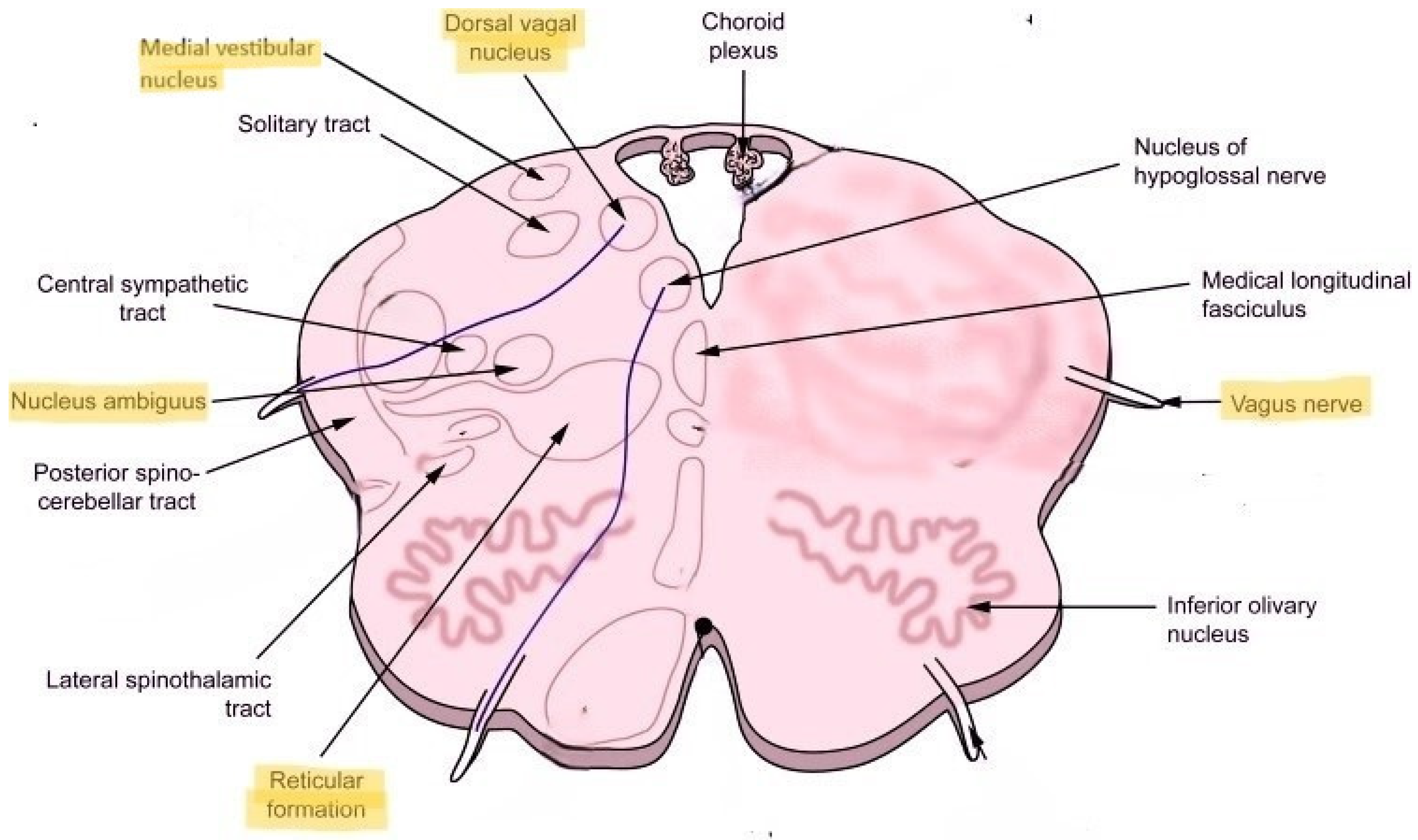 Neuroinflammation at the Dorsolateral Inferior Medulla: A Possible ...