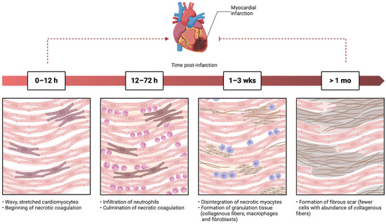 Quantification of Myocardial Biomarkers in Sudden Cardiac Deaths Using a Rapid ...