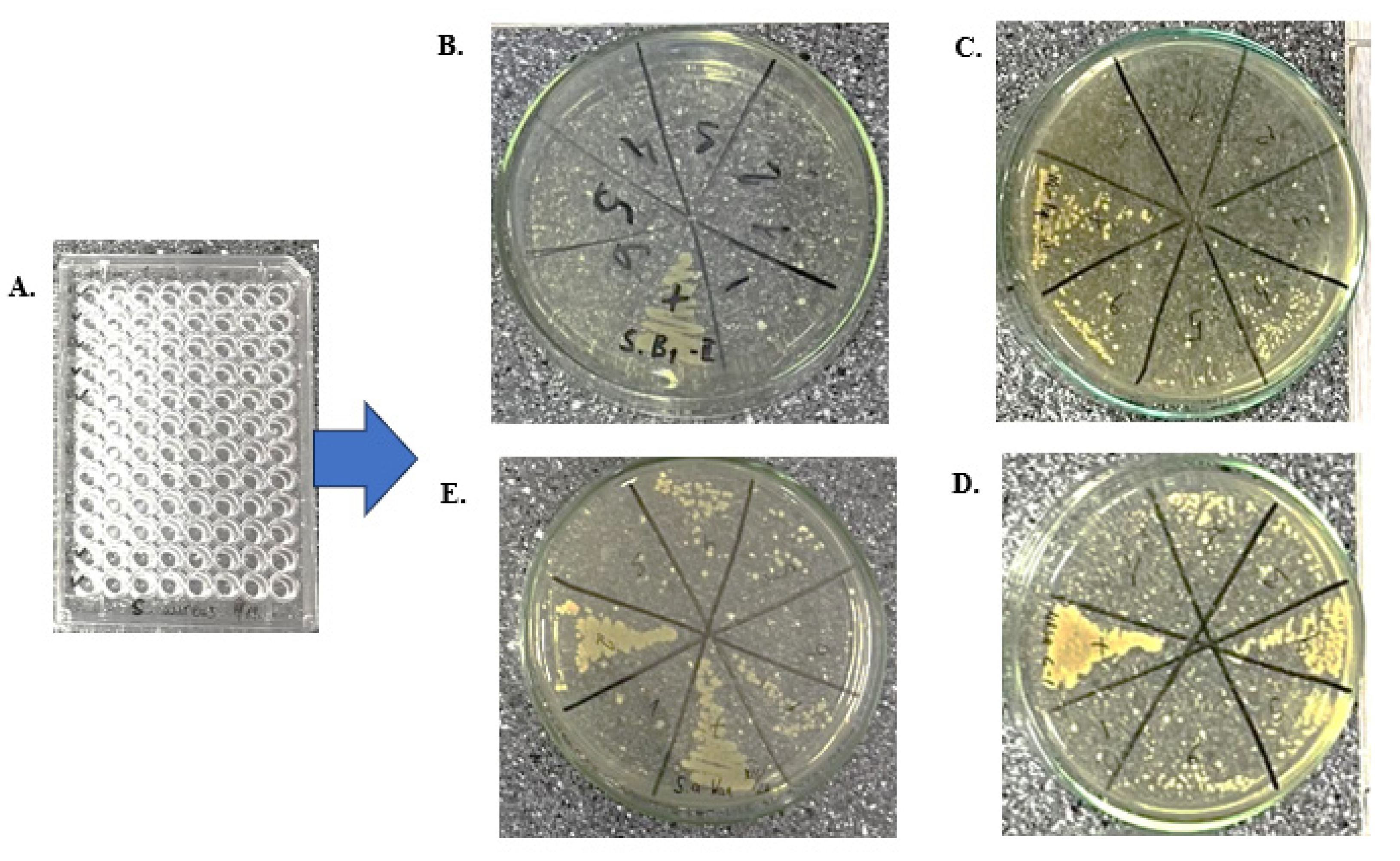 Evaluation of Liposome-Encapsulated Vancomycin Against Methicillin ...