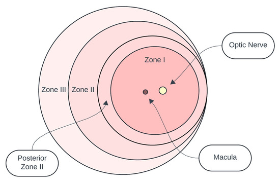 Retinopathy of Prematurity and MicroRNAs