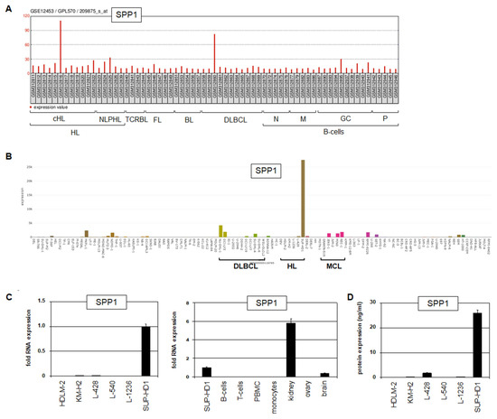 Aberrant Expression and Oncogenic Activity of SPP1 in Hodgkin Lymphoma