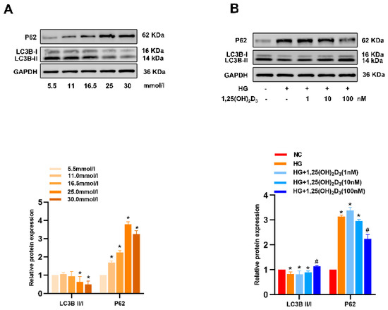 Vitamin D Attenuates Hepatic Sinusoidal Capillarization in Type 2 ...