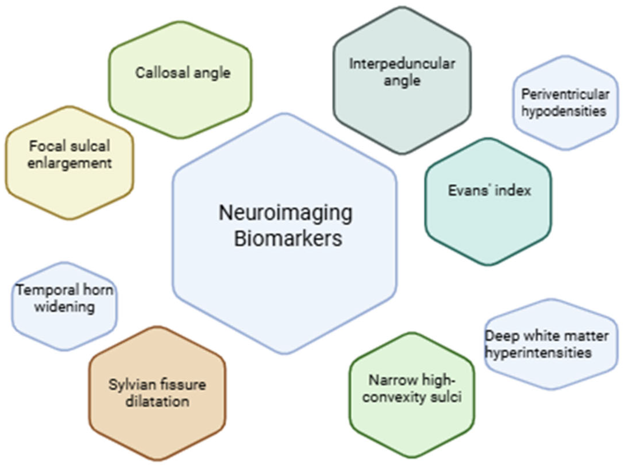 Hydrocephalus: Molecular and Neuroimaging Biomarkers in Diagnosis and Management