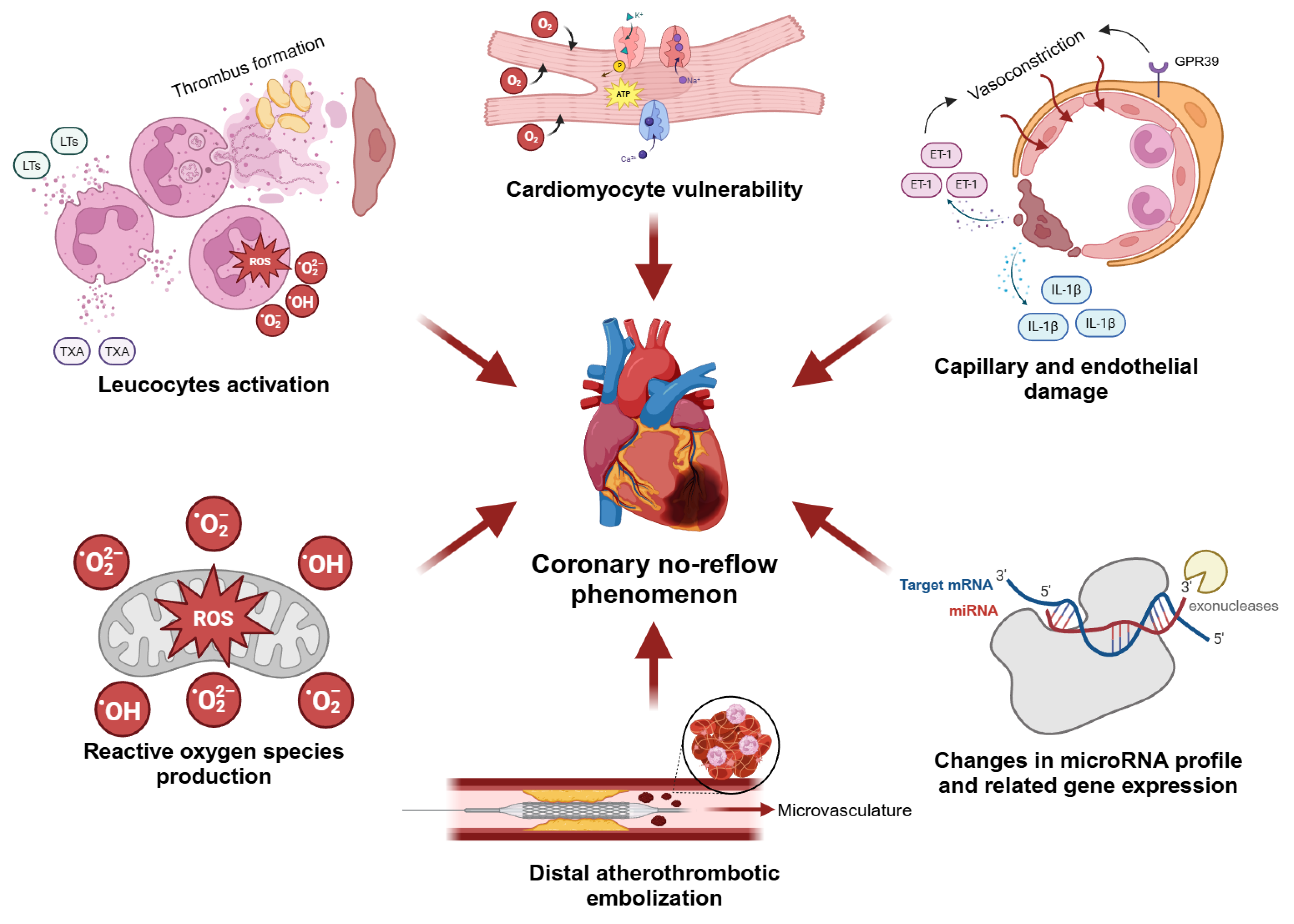 Advances in Pathophysiology and Novel Therapeutic Strategies for Coronary No-Reflow Phenomenon