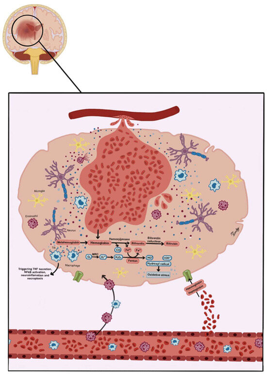 Cerebral Edema in Traumatic Brain Injury