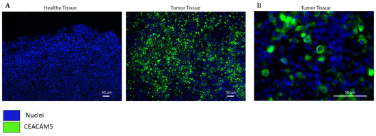 Targeting CEACAM5: Biomarker Characterization and Fluorescent Probe ...