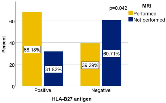 HLA-B27 Status in Rheumatic Diseases: Clinical and Immunological ...