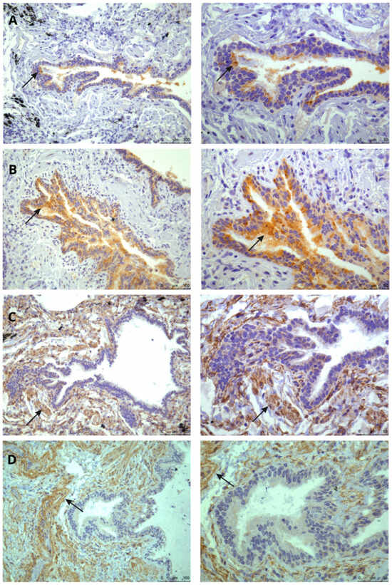 Localization and Expression of Renin–Angiotensin System Receptors in ...