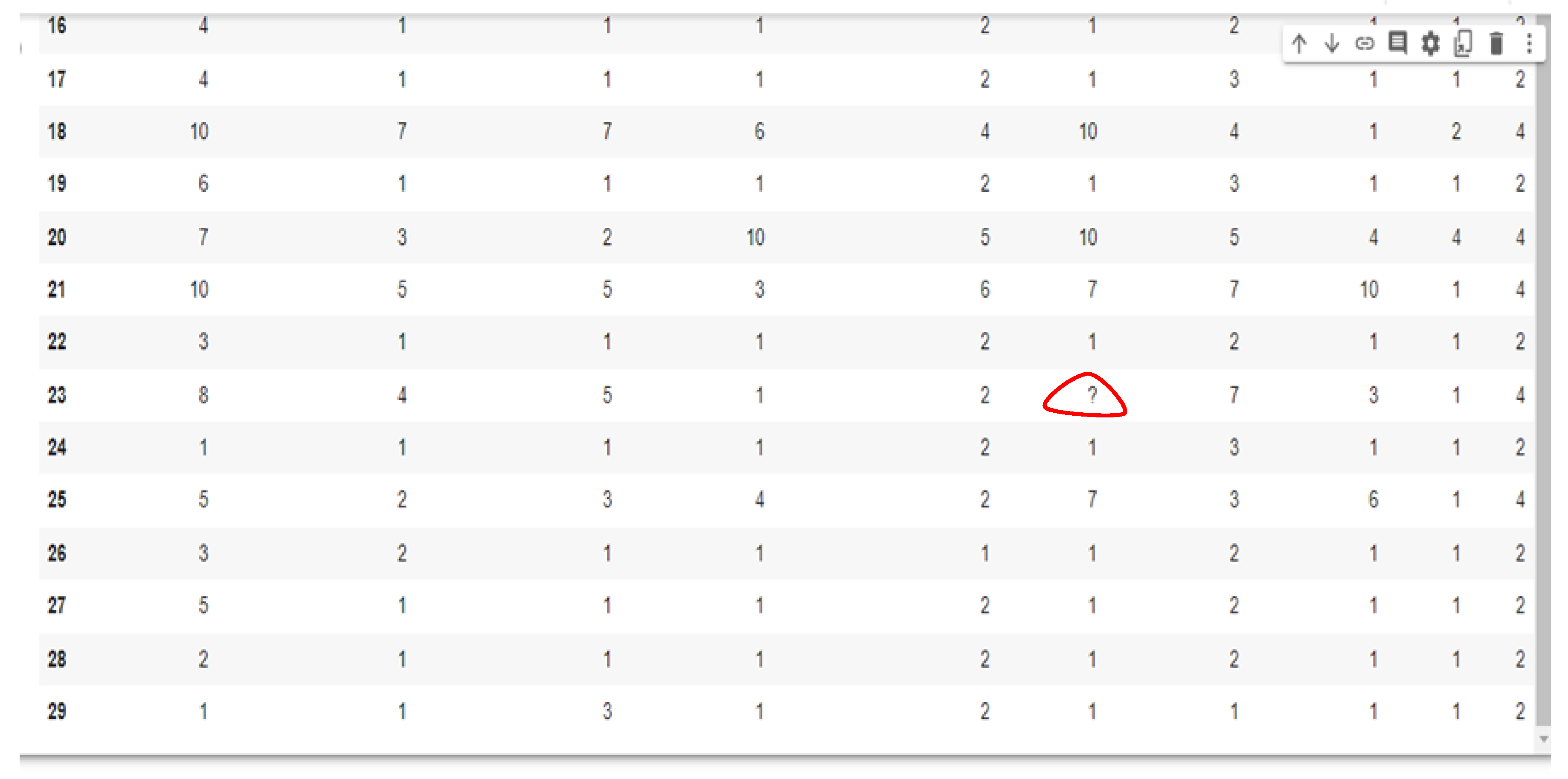 An LDA–SVM Machine Learning Model for Breast Cancer Classification