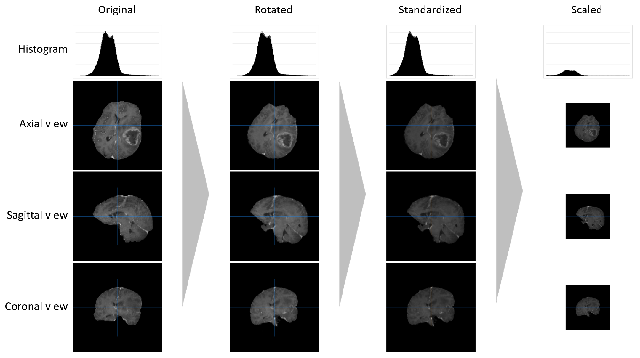Interpretable Machine Learning with Brain Image and Survival Data