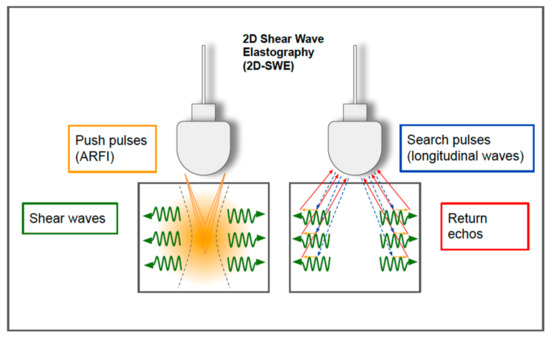 BioMedInformatics | Free Full-Text | Ultrasound Elastography: Basic Principles and Examples of ...