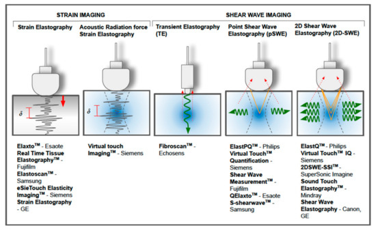 BioMedInformatics | Free Full-Text | Ultrasound Elastography: Basic Principles and Examples of ...