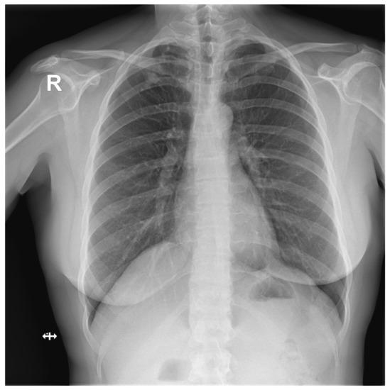 Chest X-ray Abnormality Detection by Using Artificial Intelligence: A Single-Site Retrospective ...