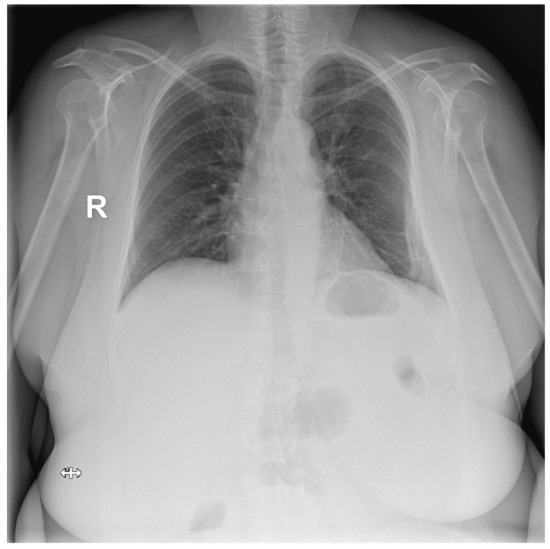 Chest X-ray Abnormality Detection by Using Artificial Intelligence: A Single-Site Retrospective ...