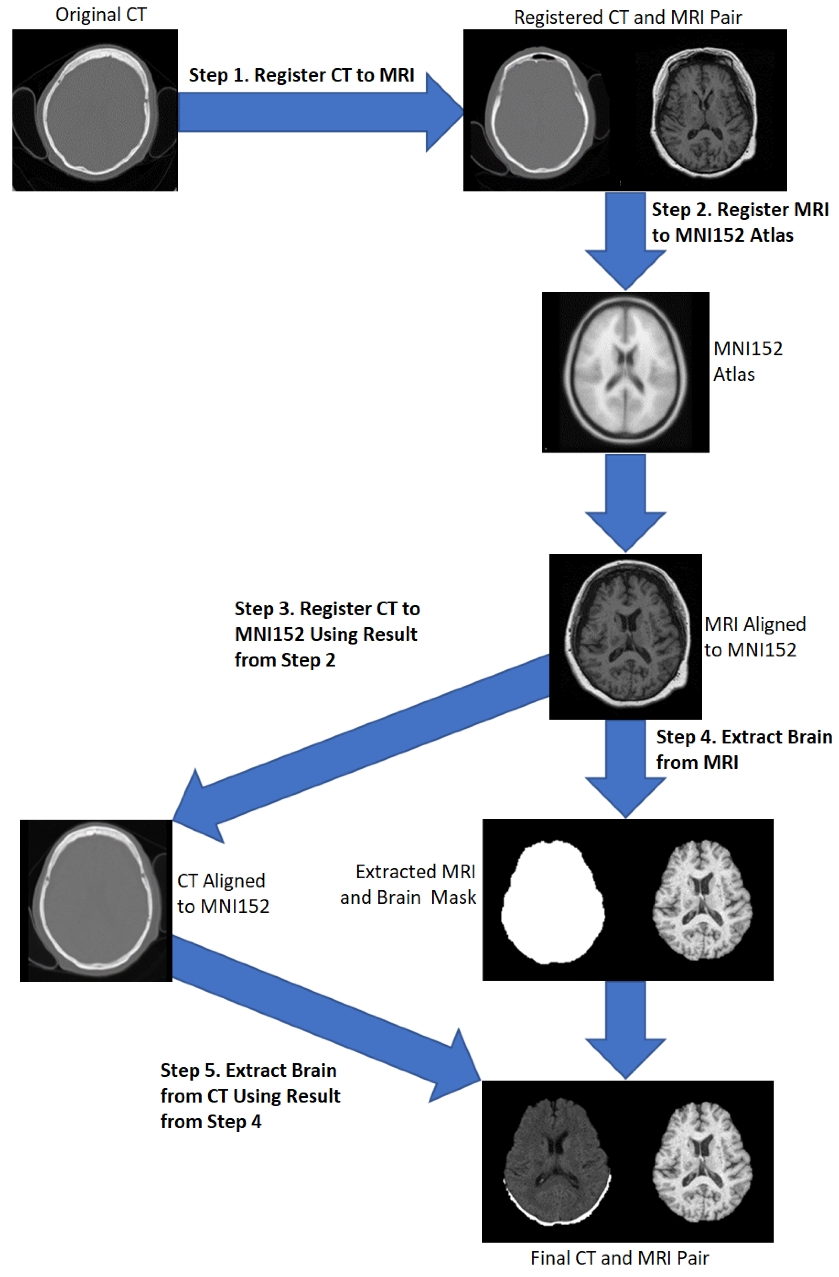 Synthetic MRI Generation from CT Scans for Stroke Patients