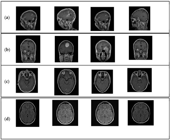 BioMedInformatics | Free Full-Text | Enhancing Brain Tumor ...