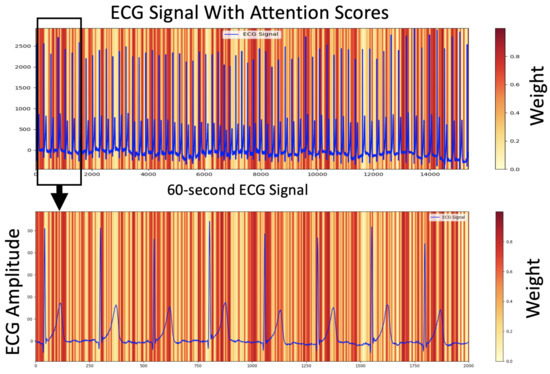 Tetanus Severity Classification in Low-Middle Income Countries through ...
