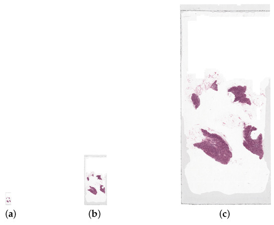 Whole Slide Image Understanding in Pathology: What Is the Salient Scale ...
