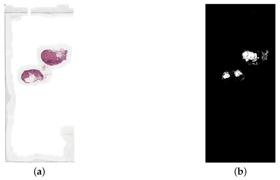 Whole Slide Image Understanding in Pathology: What Is the Salient Scale ...