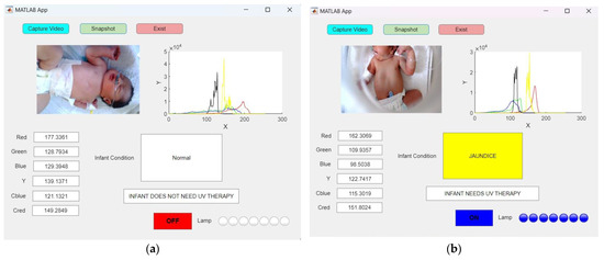 Real-Time Jaundice Detection in Neonates Based on Machine Learning Models