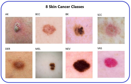 Naturalize Revolution: Unprecedented AI-Driven Precision in Skin Cancer ...