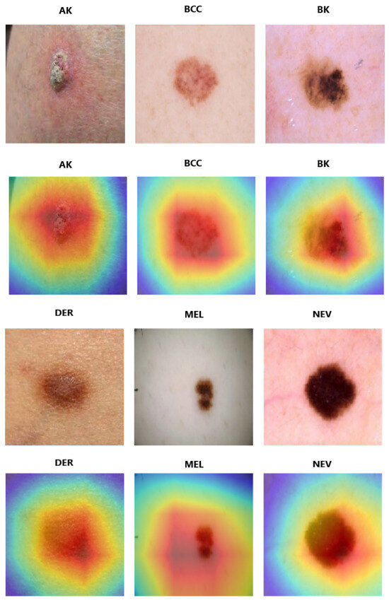 Naturalize Revolution: Unprecedented AI-Driven Precision in Skin Cancer ...