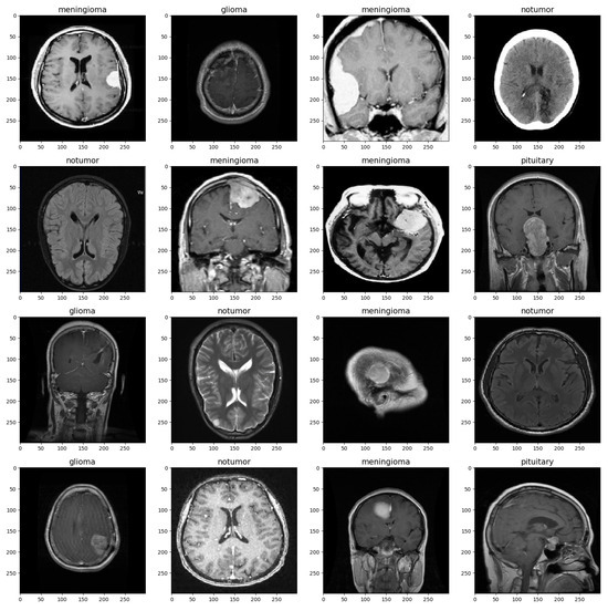 Transfer-Learning Approach for Enhanced Brain Tumor Classification in ...