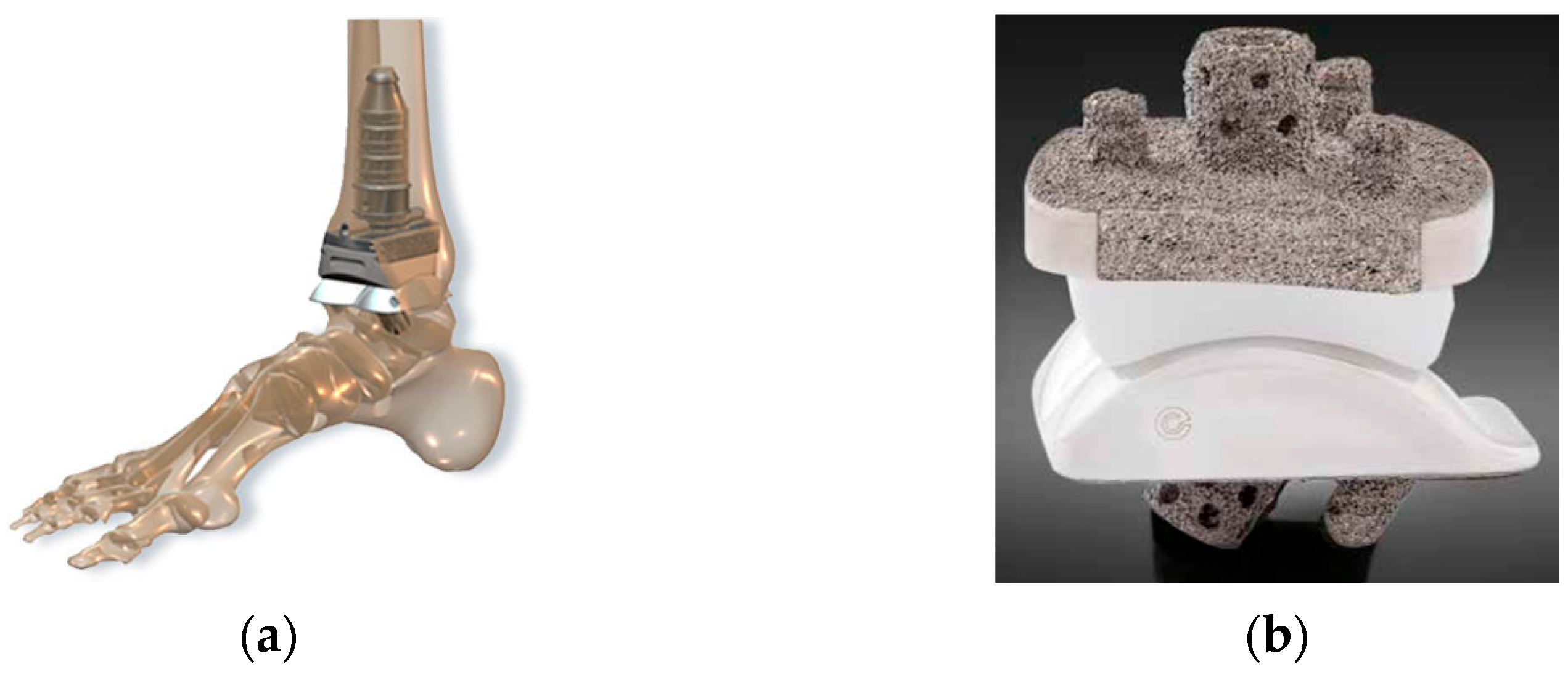 Finite Element Analysis of the Bearing Component of Total Ankle Replacement Implants during the ...