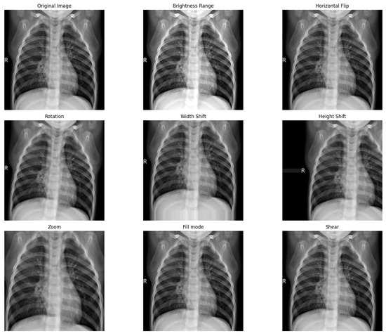 Optimizing Lung Condition Categorization through a Deep Learning ...