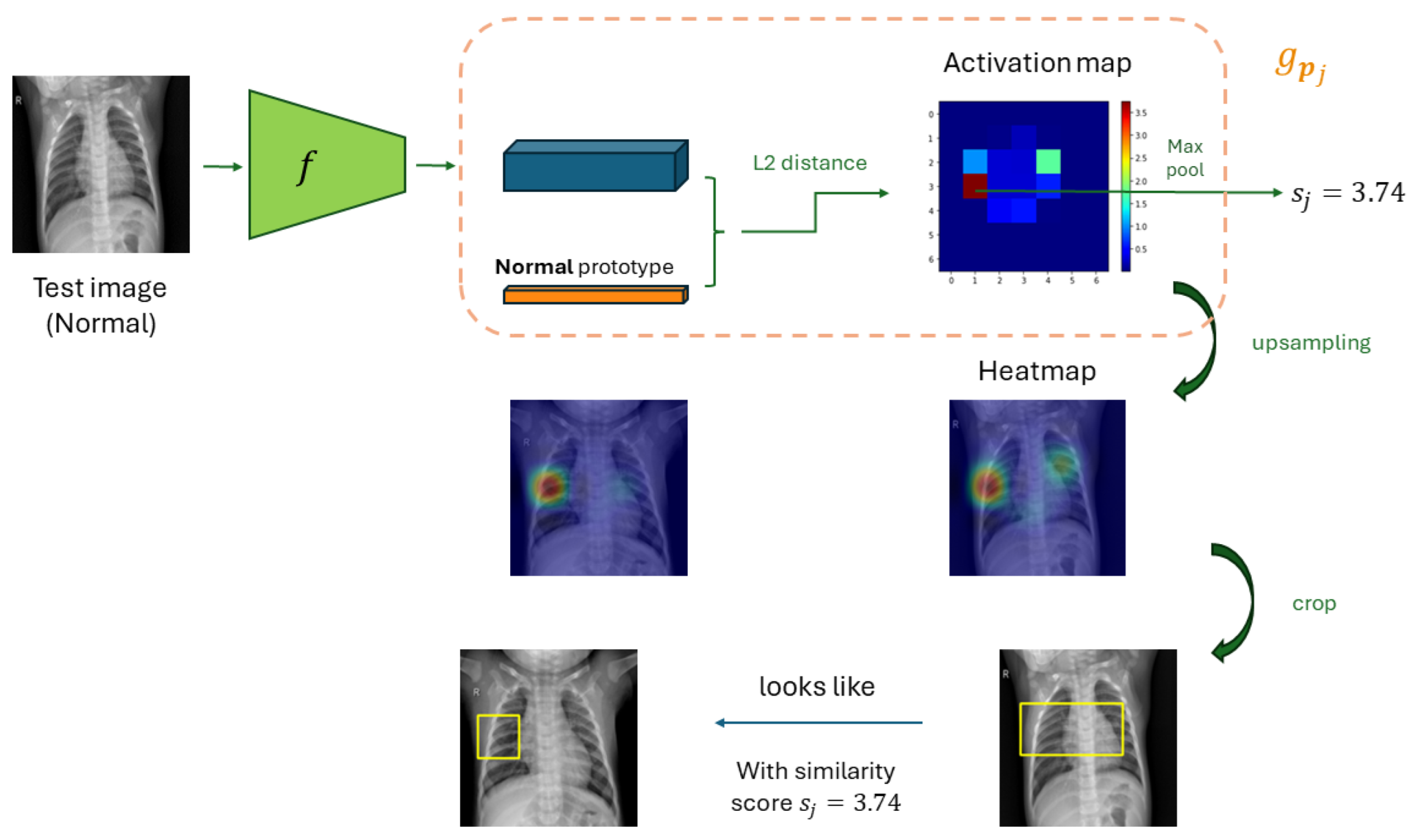 Part-Prototype Models in Medical Imaging: Applications and Current ...