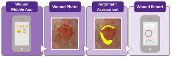 Artificial Intelligence in Wound Care: A Narrative Review of the Currently Available Mobile Apps ...