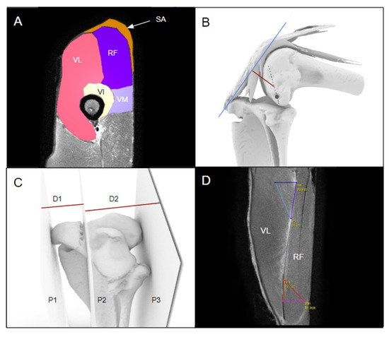 Towards a Dynamic Model of the Kangaroo Knee for Clinical Insights into ...