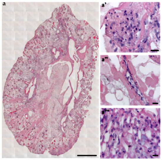 Enhancing Kidney Vasculature in Tissue Engineering—Current Trends and ...