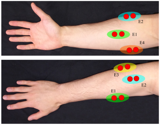 A Proposal of Bioinspired Soft Active Hand Prosthesis