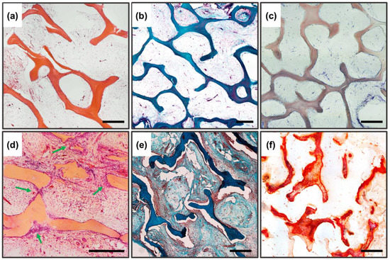 Biomimetic Remineralized Three-Dimensional Collagen Bone Matrices with an Enhanced ...