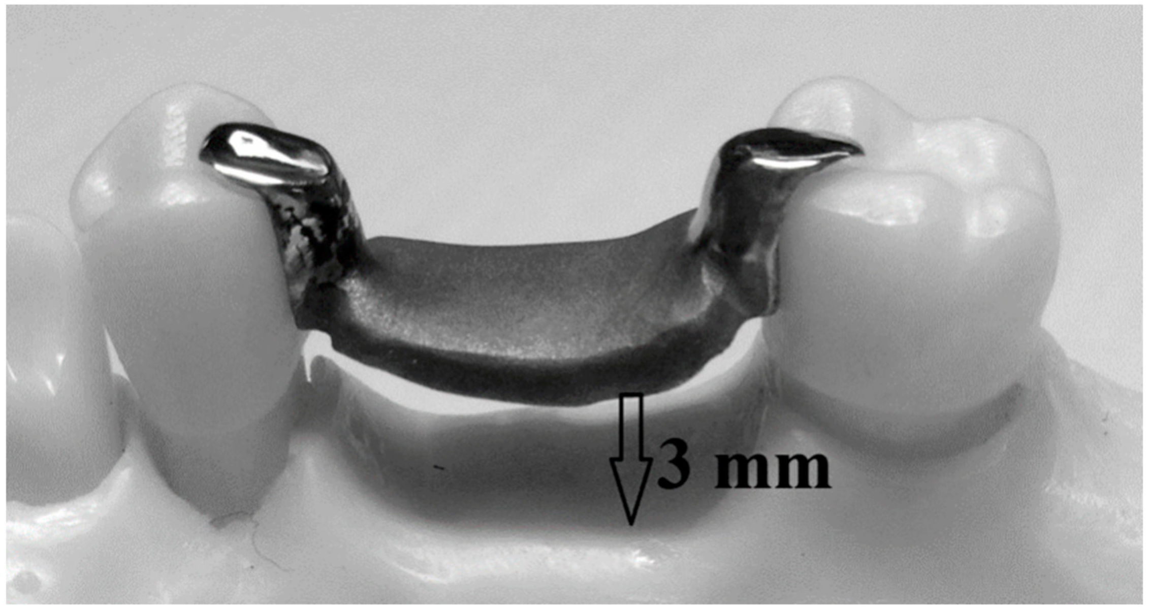 Biomimetics | Free Full-Text | An Investigation of the Fracture Loads ...