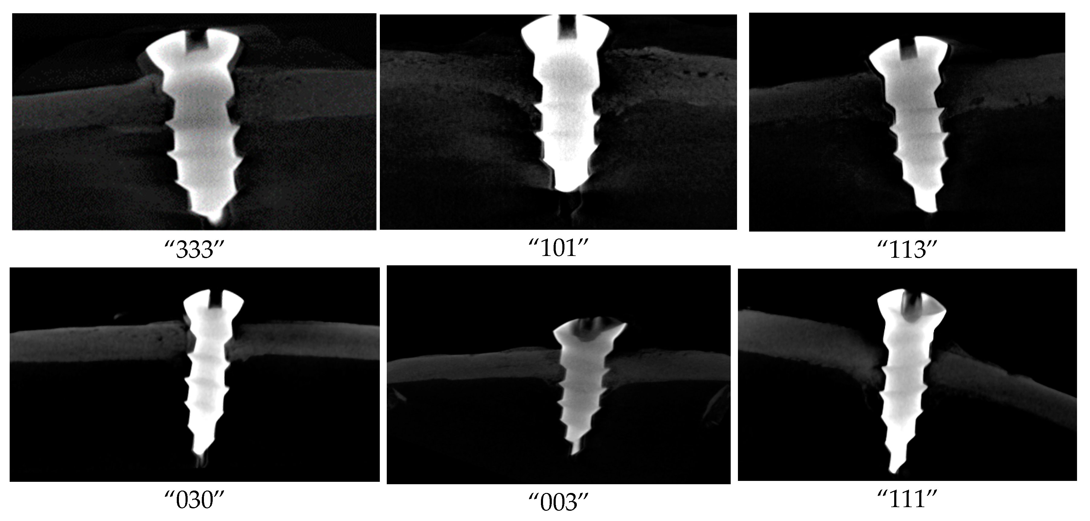 Extracorporeal Shock Wave Therapy as a Helpful Method for Rapid ...