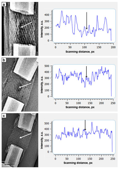 Long Bone Defect Filling with Bioactive Degradable 3D-Implant ...