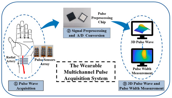 Wearable Multi-Channel Pulse Signal Acquisition System Based on ...