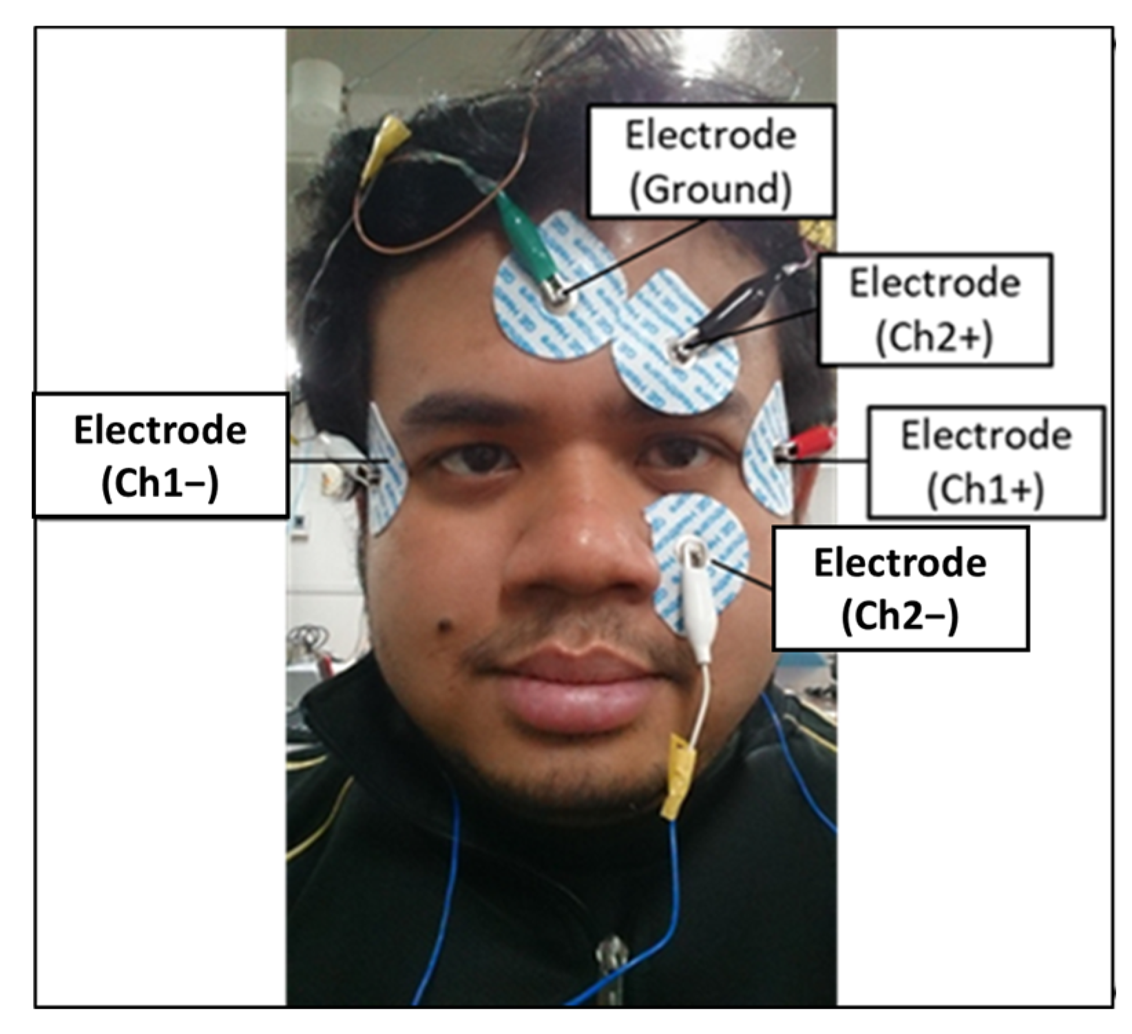 Object Grasp Control of a 3D Robot Arm by Combining EOG Gaze Estimation ...