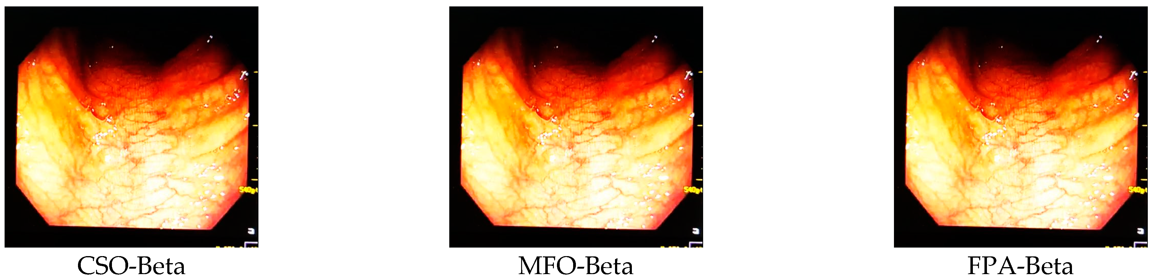 Adaptive Image Enhancement Algorithm Based on Variable Step Fruit Fly Optimization Algorithm and ...